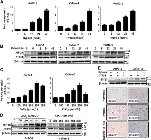 STK33 Promotes Growth and Progression of Pancreatic Cancer as a ...