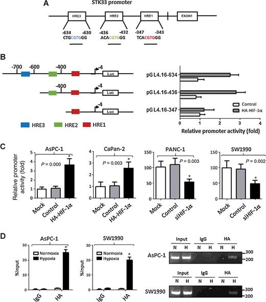 STK33 Promotes Growth and Progression of Pancreatic Cancer as a ...