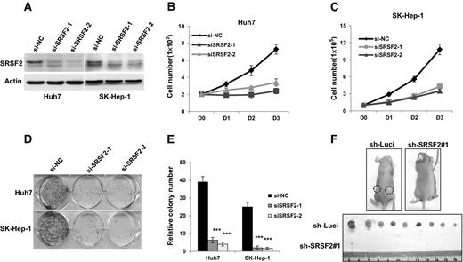 SRSF2 Regulates Alternative Splicing to Drive Hepatocellular Carcinoma ...