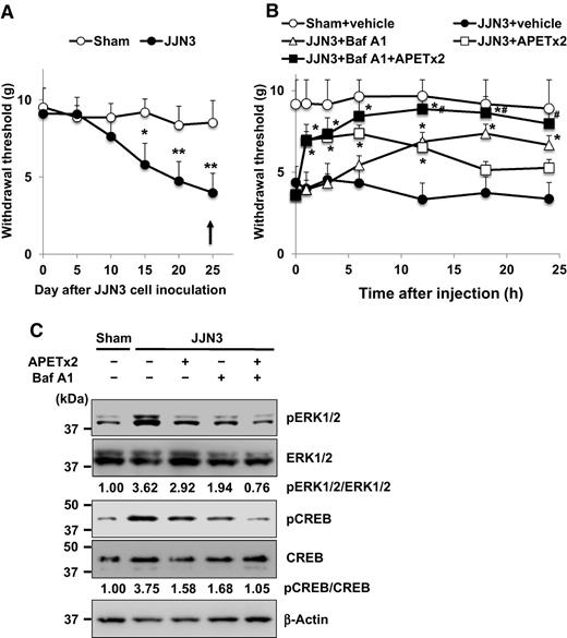 Bone Pain Induced by Multiple Myeloma Is Reduced by Targeting V-ATPase ...