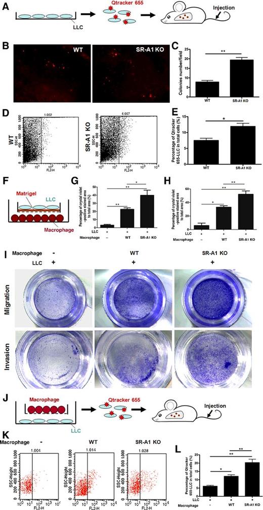 Scavenger Receptor A1 Prevents Metastasis of Non–Small Cell Lung Cancer ...