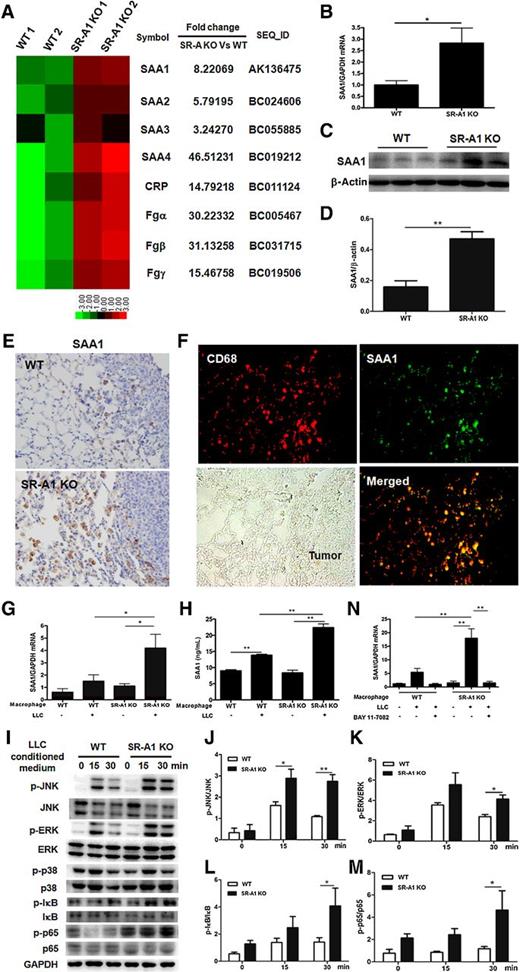 Scavenger Receptor A1 Prevents Metastasis of Non–Small Cell Lung Cancer ...