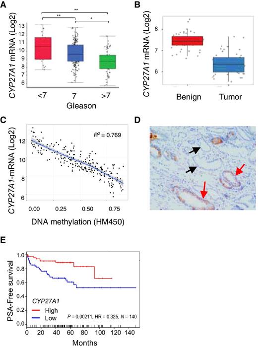 CYP27A1 Loss Dysregulates Cholesterol Homeostasis in Prostate Cancer ...