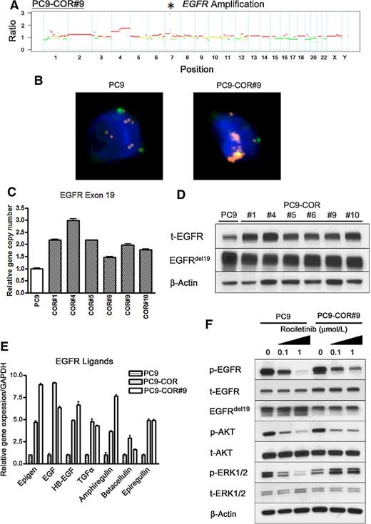 Amplification of EGFR Wild-Type Alleles in Non–Small Cell Lung Cancer ...
