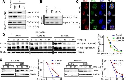 CBX8 Exhibits Oncogenic Activity via AKT/β-Catenin Activation in ...