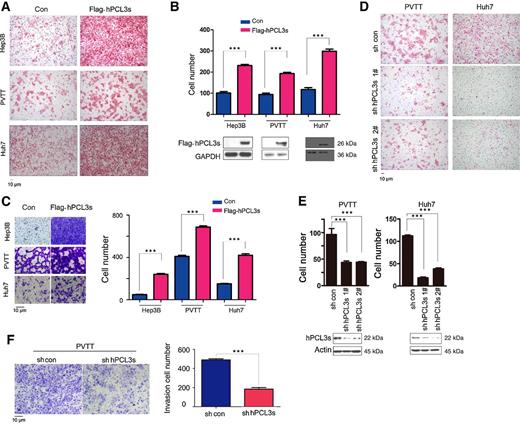 hPCL3s Promotes Hepatocellular Carcinoma Metastasis by Activating β ...