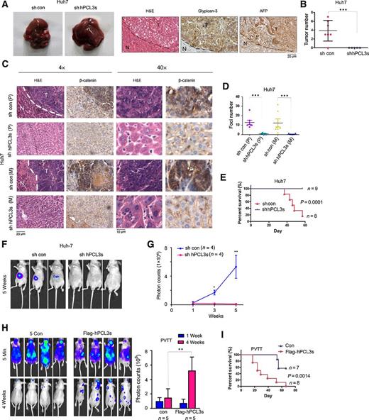 hPCL3s Promotes Hepatocellular Carcinoma Metastasis by Activating β ...