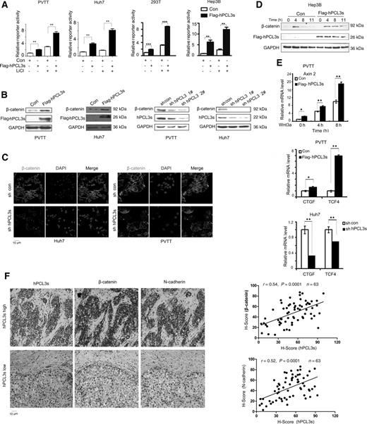 hPCL3s Promotes Hepatocellular Carcinoma Metastasis by Activating β ...
