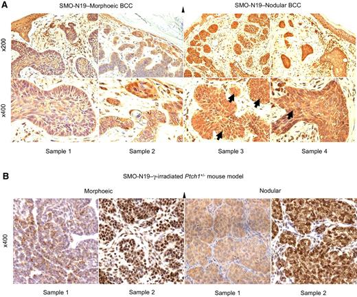 A Novel Mechanism for Activation of GLI1 by Nuclear SMO That Escapes ...