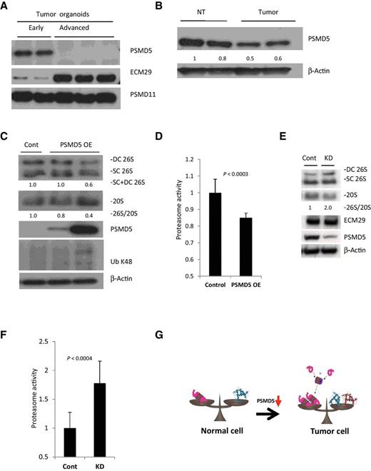 PSMD5 Inactivation Promotes 26S Proteasome Assembly during Colorectal ...