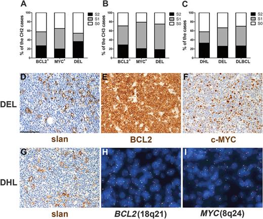 slan+ Monocytes and Macrophages Mediate CD20-Dependent B-cell Lymphoma ...