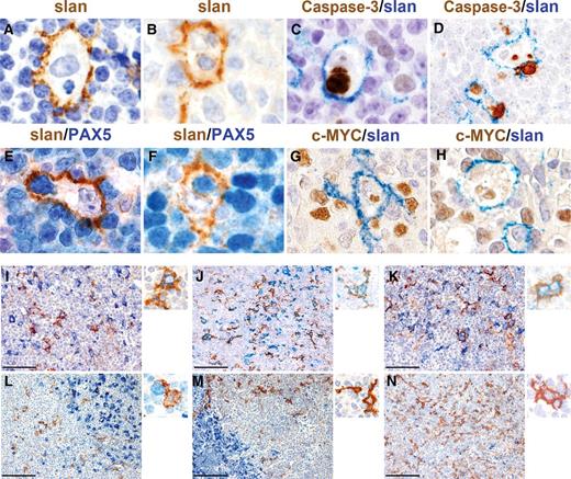 slan+ Monocytes and Macrophages Mediate CD20-Dependent B-cell Lymphoma ...
