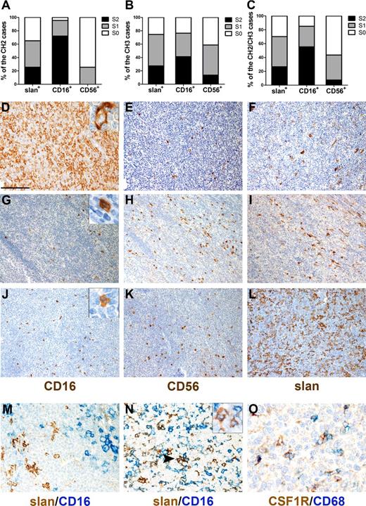 slan+ Monocytes and Macrophages Mediate CD20-Dependent B-cell Lymphoma ...