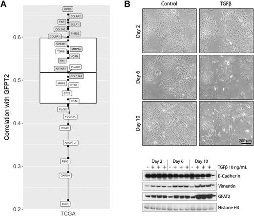 GFPT2-Expressing Cancer-Associated Fibroblasts Mediate Metabolic ...