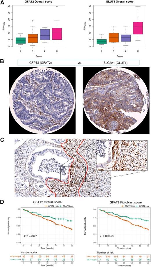 GFPT2-Expressing Cancer-Associated Fibroblasts Mediate Metabolic ...