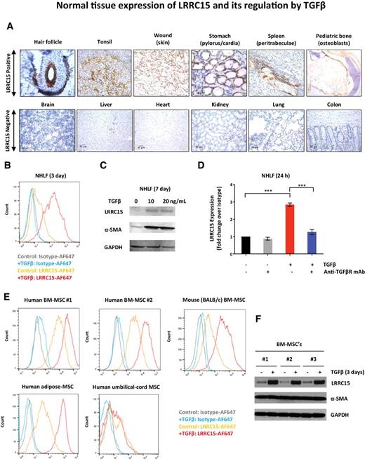 LRRC15 Is a Novel Mesenchymal Protein and Stromal Target for Antibody ...