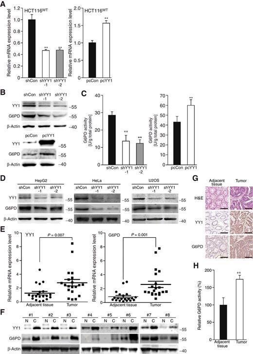 Transcription Factor YY1 Promotes Cell Proliferation by Directly ...