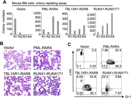 Recurrent RARB Translocations in Acute Promyelocytic Leukemia Lacking ...