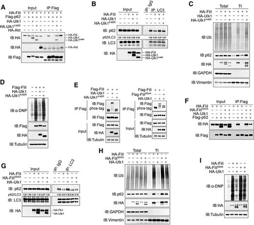 Flightless-I Blocks p62-Mediated Recognition of LC3 to Impede Selective ...