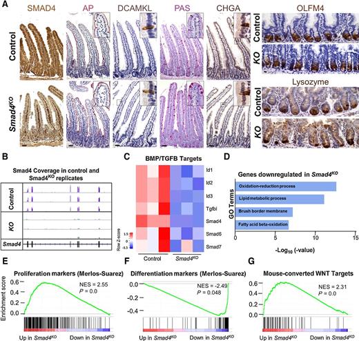 SMAD4 Suppresses WNT-Driven Dedifferentiation and Oncogenesis in the ...
