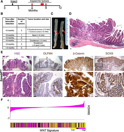 SMAD4 Suppresses WNT-Driven Dedifferentiation and Oncogenesis in the ...