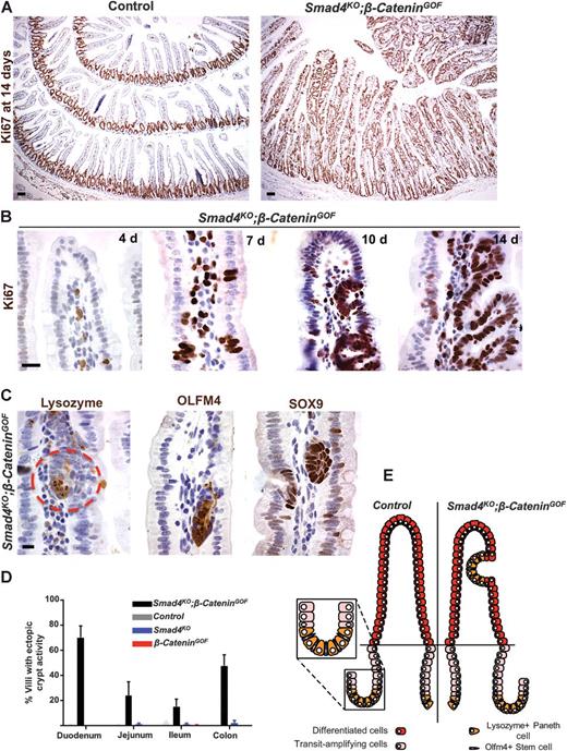 SMAD4 Suppresses WNT-Driven Dedifferentiation and Oncogenesis in the ...