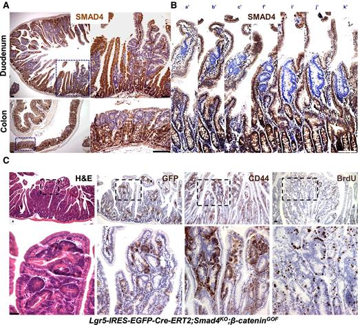 SMAD4 Suppresses WNT-Driven Dedifferentiation and Oncogenesis in the ...