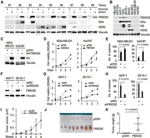 FBXO22 Possesses Both Protumorigenic and Antimetastatic Roles in Breast ...