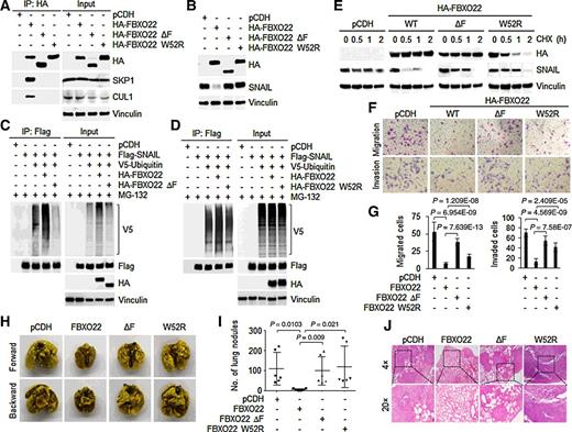 FBXO22 Possesses Both Protumorigenic and Antimetastatic Roles in Breast ...
