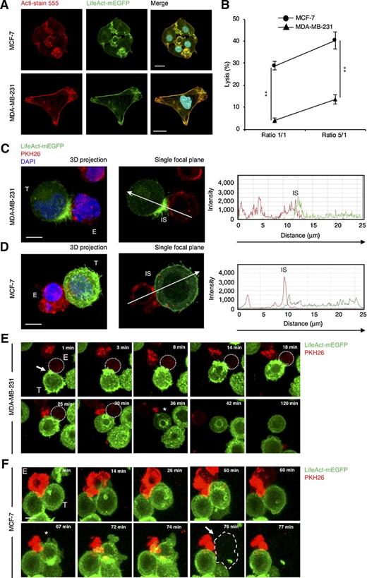 Actin Cytoskeleton Remodeling Drives Breast Cancer Cell Escape from ...