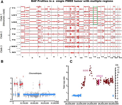 Multiregional Sequencing Reveals Genomic Alterations and Clonal ...