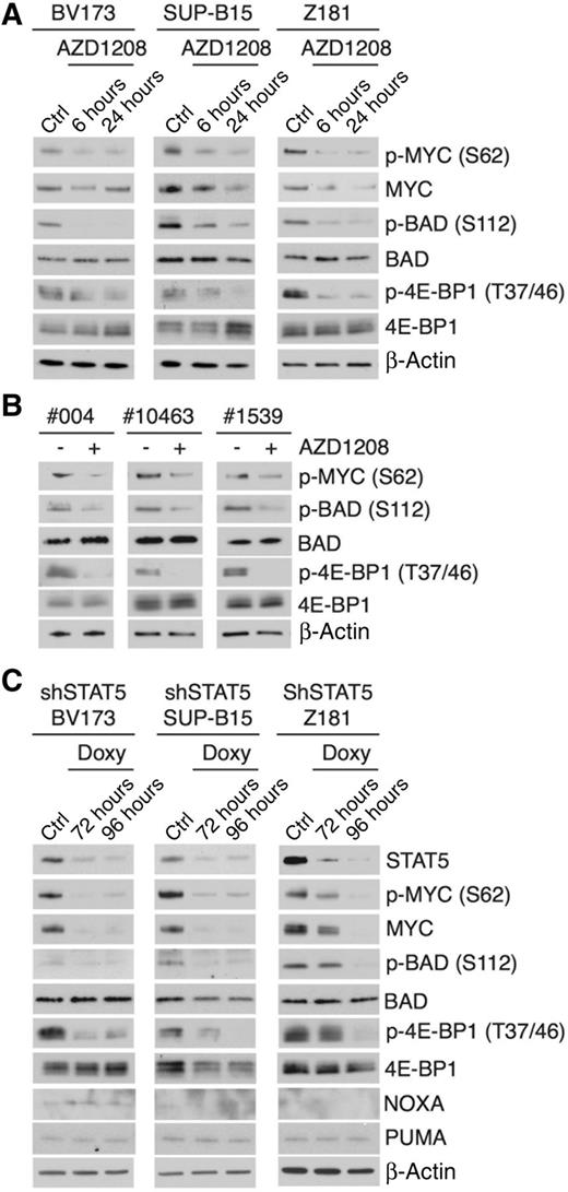 Targeting STAT5 or STAT5-Regulated Pathways Suppresses Leukemogenesis ...