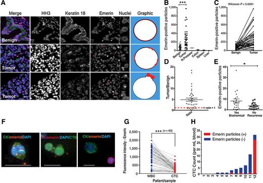 Emerin Deregulation Links Nuclear Shape Instability to Metastatic ...