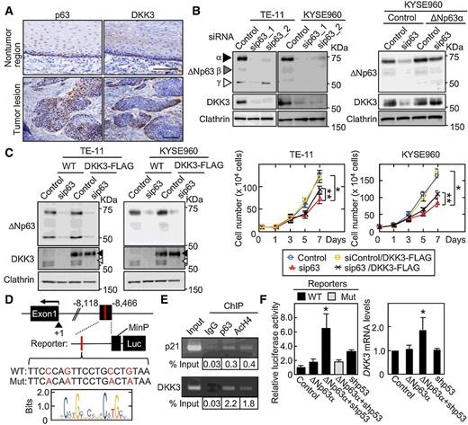 p63-Dependent Dickkopf3 Expression Promotes Esophageal Cancer Cell ...