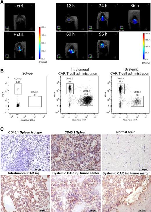 NKG2D-Based CAR T Cells and Radiotherapy Exert Synergistic Efficacy in ...