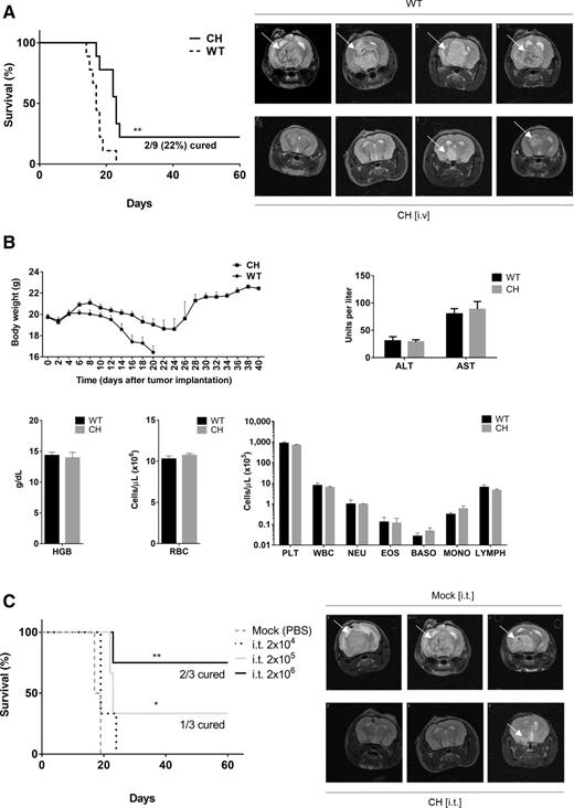 NKG2D-Based CAR T Cells and Radiotherapy Exert Synergistic Efficacy in ...