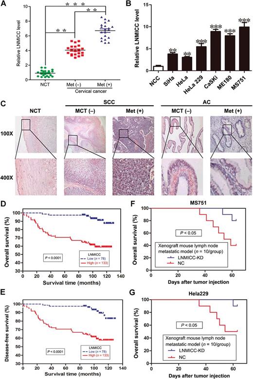 LNMICC Promotes Nodal Metastasis of Cervical Cancer by Reprogramming ...