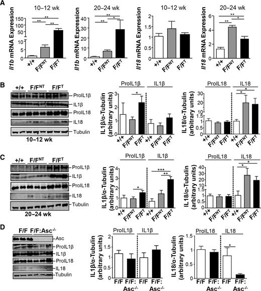 Inflammasome Adaptor ASC Suppresses Apoptosis of Gastric Cancer Cells ...