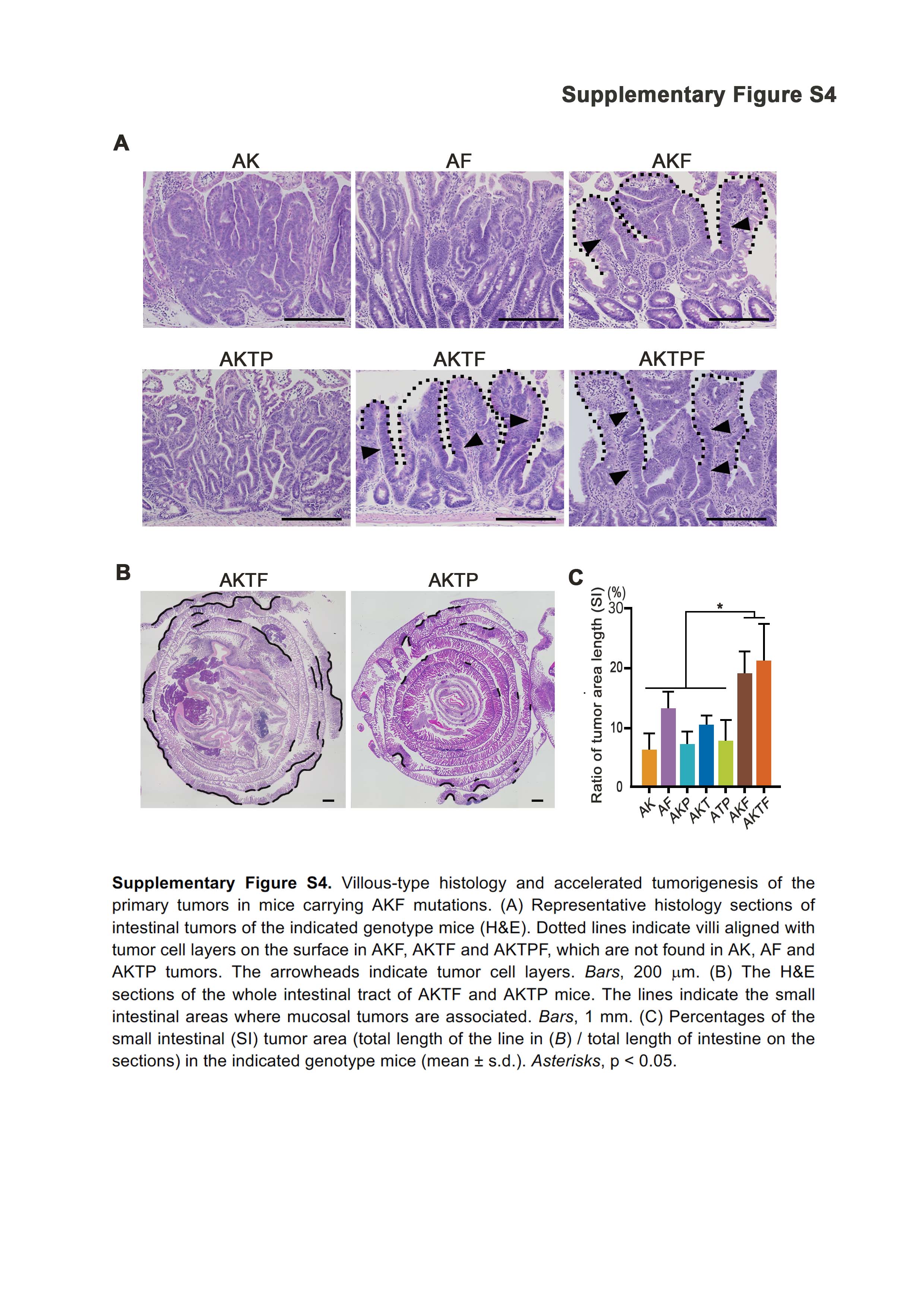Combined Mutation of Apc, Kras, and Tgfbr2 Effectively Drives ...