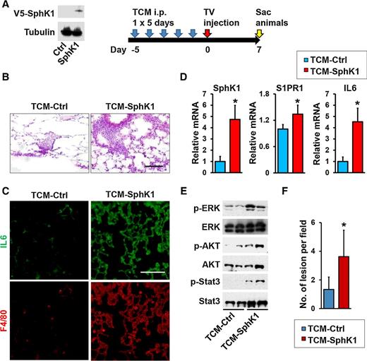 Targeting the SphK1/S1P/S1PR1 Axis That Links Obesity, Chronic ...