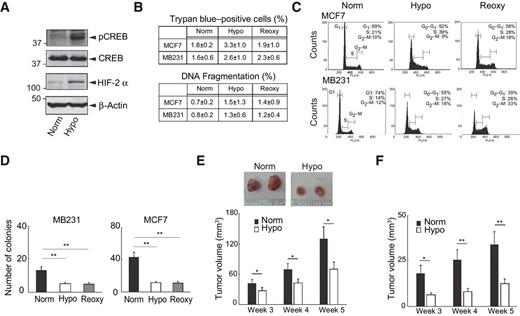 Pyruvate Dehydrogenase PDH-E1β Controls Tumor Progression by Altering ...