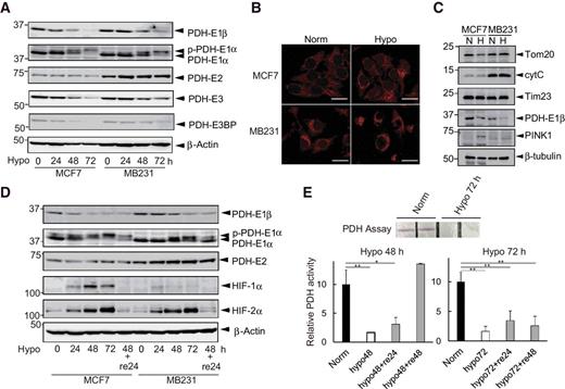Pyruvate Dehydrogenase PDH-E1β Controls Tumor Progression by Altering ...