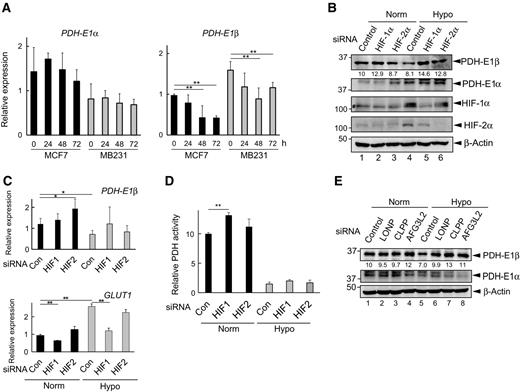 Pyruvate Dehydrogenase PDH-E1β Controls Tumor Progression by Altering ...