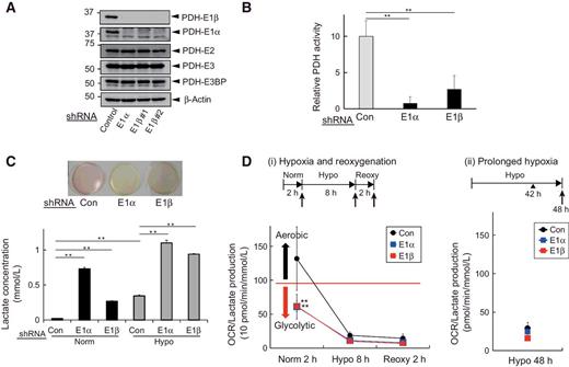 Pyruvate Dehydrogenase PDH-E1β Controls Tumor Progression by Altering ...