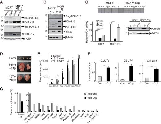 Pyruvate Dehydrogenase PDH-E1β Controls Tumor Progression by Altering ...