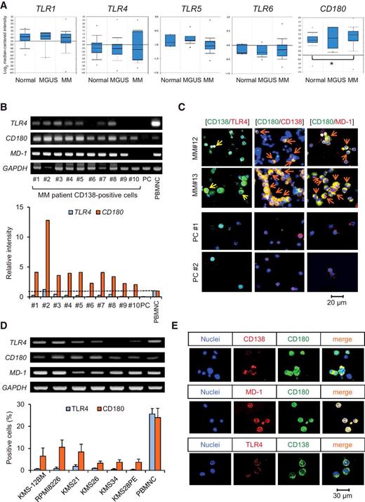 Myeloma Cells Are Activated in Bone Marrow Microenvironment by the ...