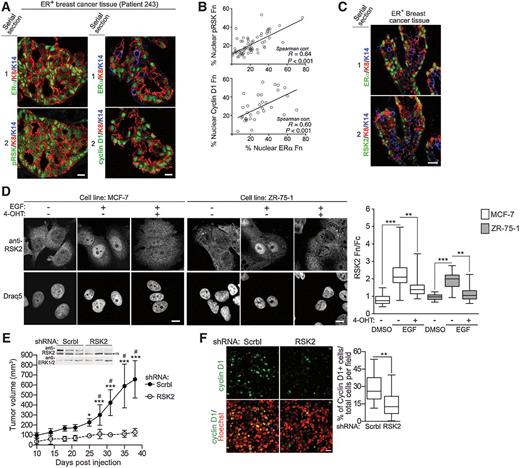 ERα-Mediated Nuclear Sequestration of RSK2 Is Required for ER+ Breast ...