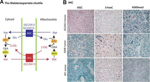 Germline Mutations in the Mitochondrial 2-Oxoglutarate/Malate Carrier ...