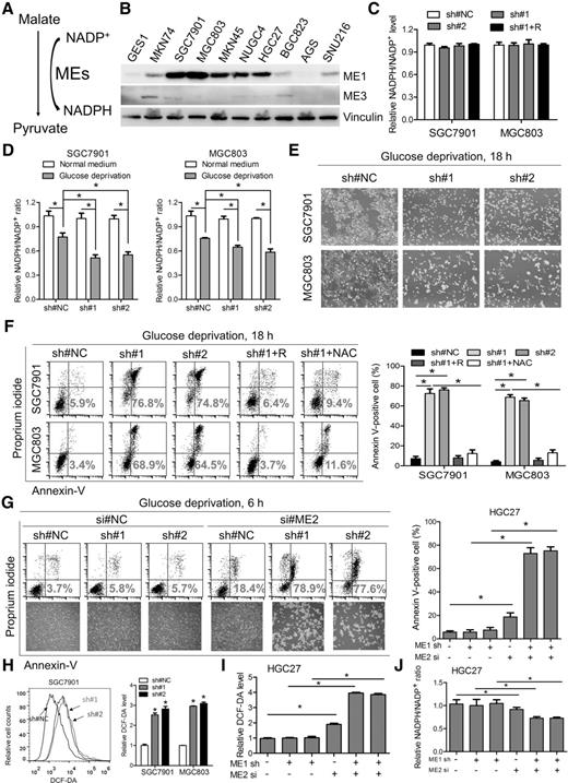 ME1 Regulates NADPH Homeostasis to Promote Gastric Cancer Growth and ...