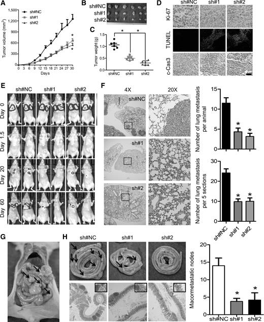 ME1 Regulates NADPH Homeostasis to Promote Gastric Cancer Growth and ...